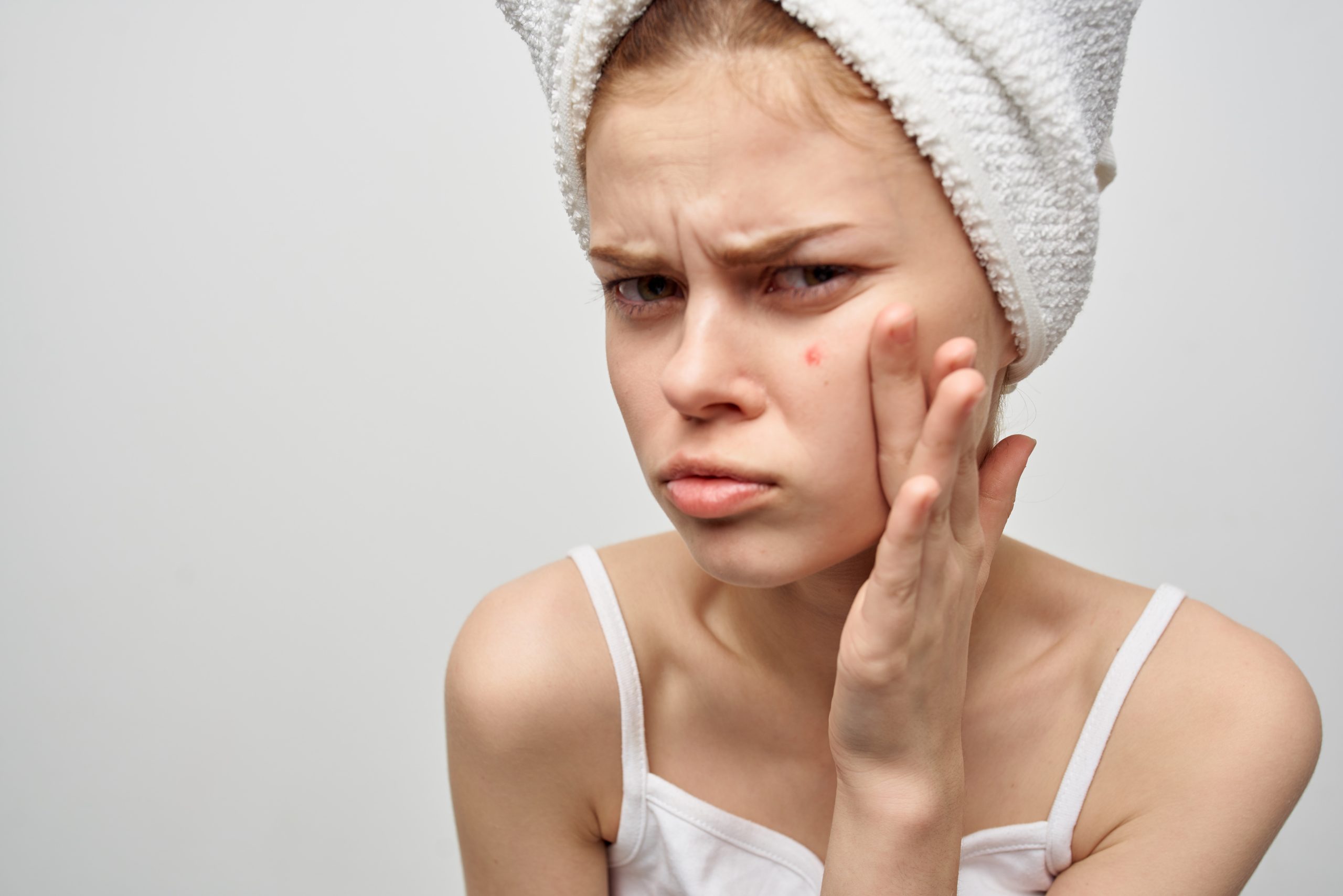 acne come curarla in zona Prati a Roma, trattamenti moderni per